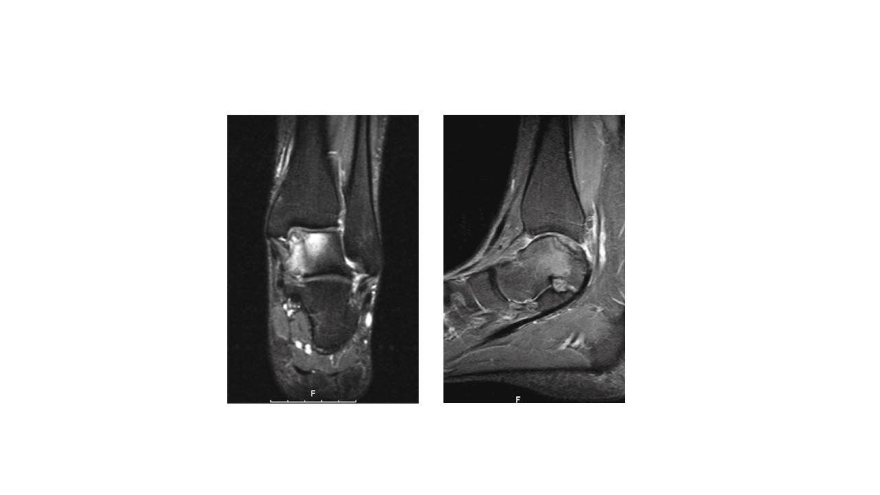 London Sports Foot And Ankle